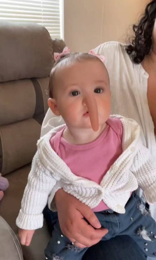 Unique Deformities: People Born with Features That Amaze