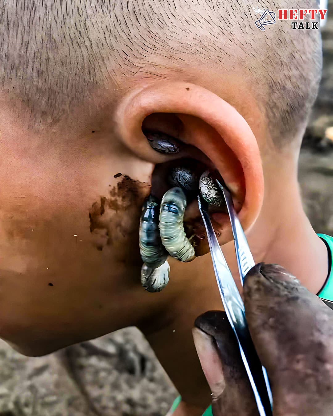 Lizard Found in Man’s Ear: Shocking Camping Story